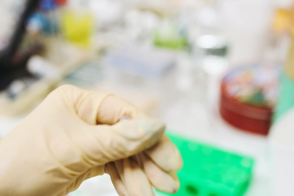 What Is Phlebotomy: Phlebotomy Definition, Methods, Risk & Side Effects